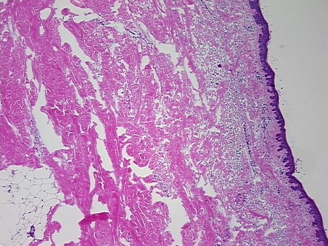 Frozen Tissue Sections, Skin | CS544250 | OriGene Technologies Inc.