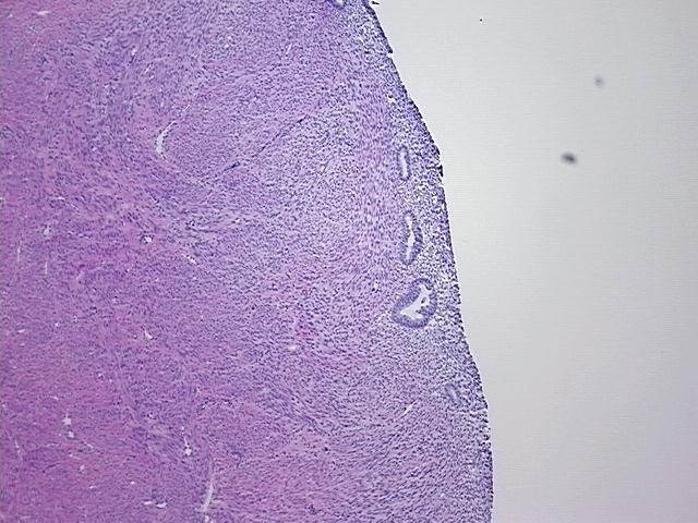 Frozen Tissue Sections, Uterus | OriGene Technologies Inc.