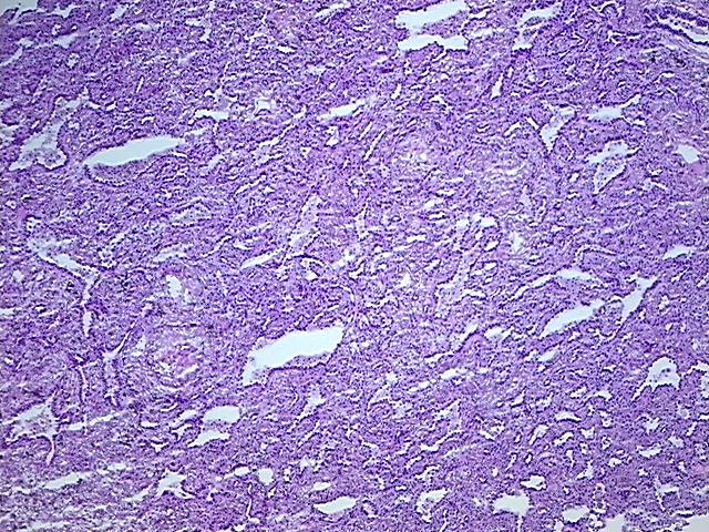 Frozen Tissue Sections, Lung: right upper lobe | CS556694 | OriGene ...