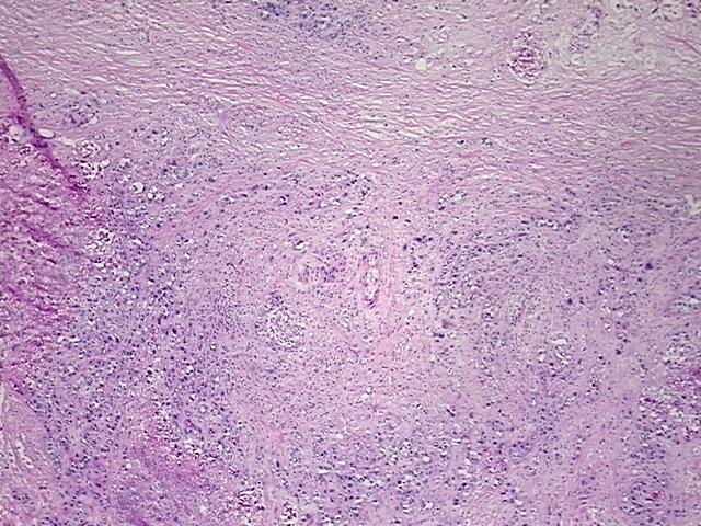 Frozen Tissue Sections, Renal pelvis | OriGene Technologies Inc.