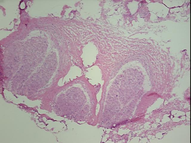 Frozen Tissue Sections, Peripheral nerve | CS600519 | OriGene ...