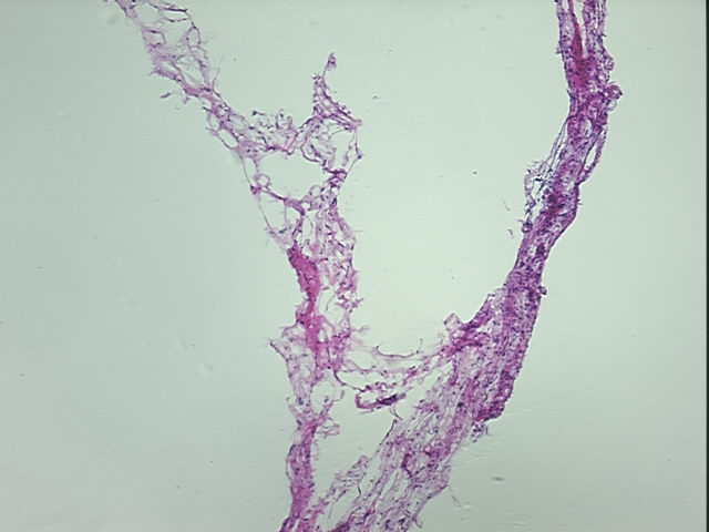 Frozen Tissue Sections, Adipose tissue | CS600593 | OriGene ...