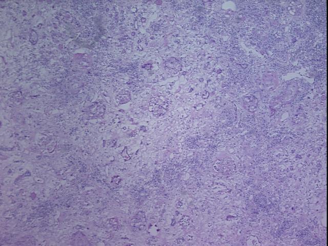 Frozen Tissue Sections, Kidney | CS600686 | OriGene Technologies Inc.