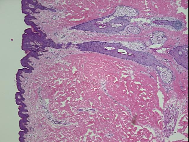 Frozen Tissue Sections, Skin | CS600864 | OriGene Technologies Inc.