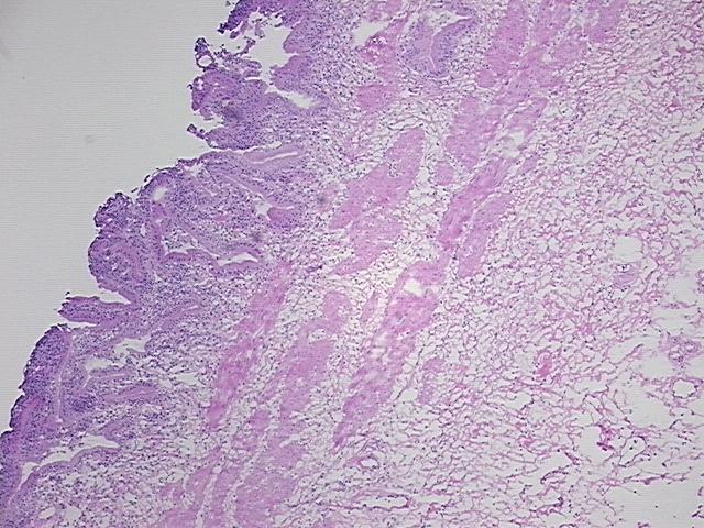 Frozen Tissue Sections, Gallbladder | OriGene Technologies Inc.