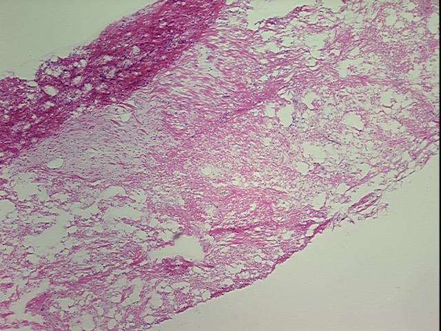 Frozen Tissue Sections, Adipose tissue | OriGene Technologies Inc.