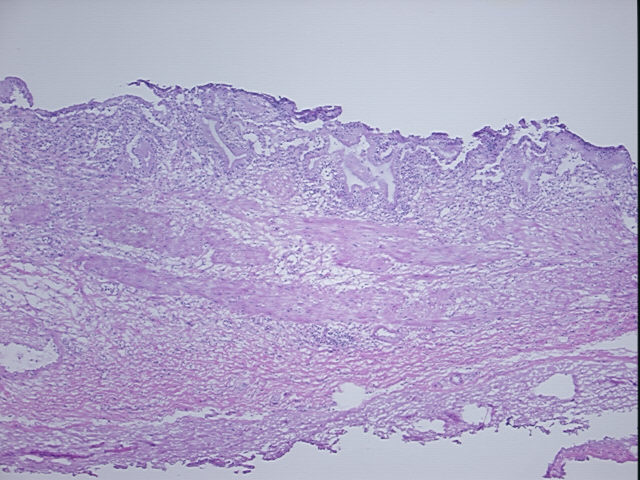 Frozen Tissue Sections, Gallbladder | CS601644 | OriGene Technologies Inc.