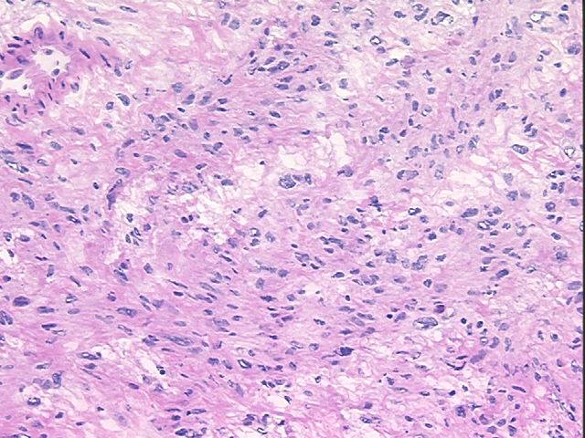 CS602125 – Frozen Tissue Sections, Smooth muscle | OriGene
