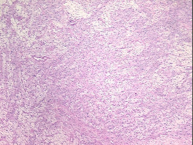 CS602125 – Frozen Tissue Sections, Smooth muscle | OriGene