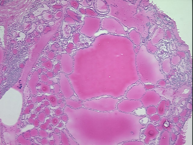 Frozen Tissue Sections, Thyroid gland | CS602262 | OriGene Technologies ...