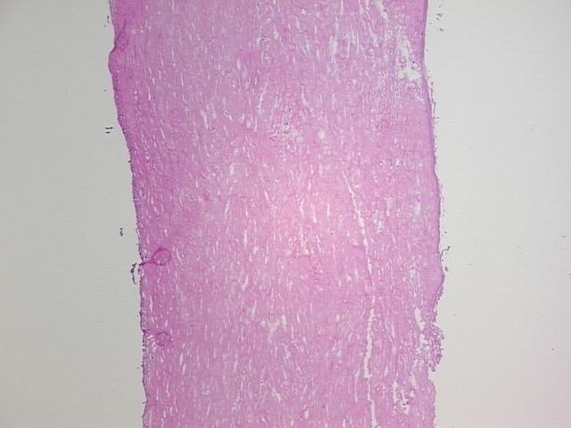 Frozen Tissue Sections, Pleura | OriGene Technologies Inc.