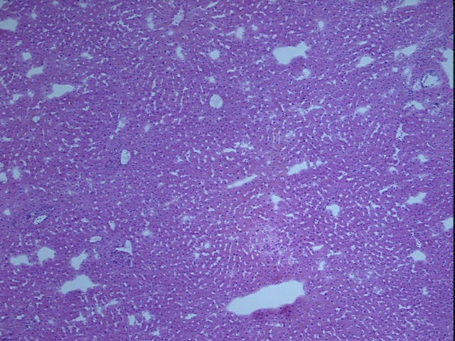 Frozen Tissue Sections, Liver | CS603862 | OriGene Technologies Inc.