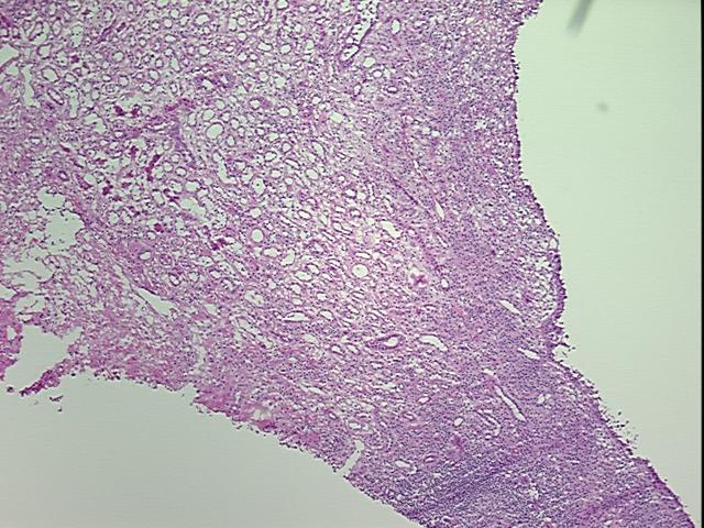 Frozen Tissue Sections, Kidney | CS604484 | OriGene Technologies Inc.