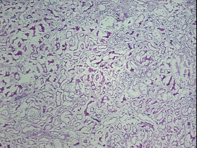 Frozen Tissue Sections, Kidney | CS604703 | OriGene Technologies Inc.