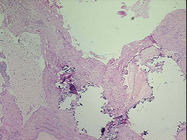 Tissue FFPE Sections, Kidney | OriGene Technologies Inc.