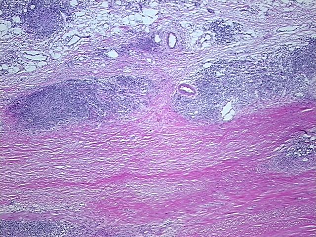 Frozen Tissue Sections, Gallbladder | CS609356 | OriGene Technologies Inc.
