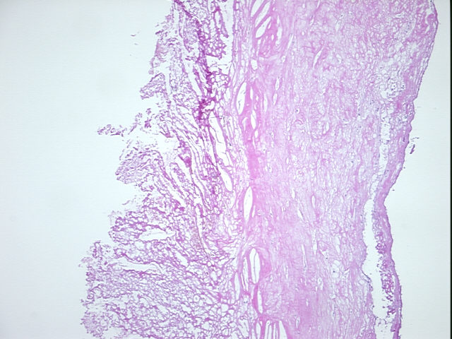 Frozen Tissue Sections, Aorta | OriGene Technologies Inc.