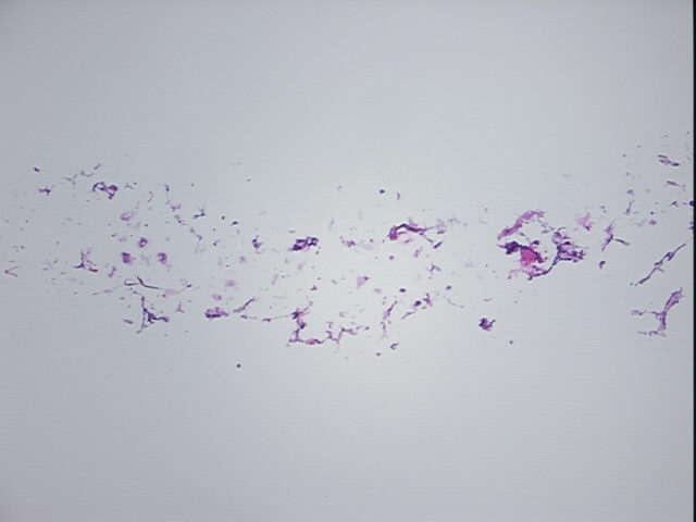 Frozen Tissue Sections, Adipose tissue | CS611846 | OriGene ...