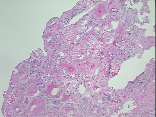 Frozen Tissue Sections, Thyroid gland | CS613678 | OriGene Technologies ...