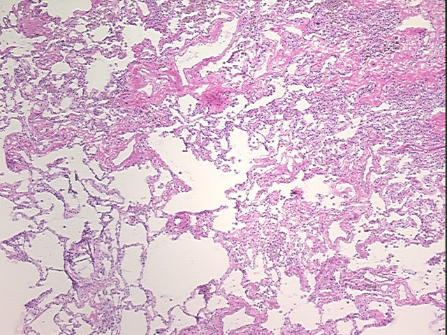 Frozen Tissue Sections, Lung | OriGene Technologies Inc.