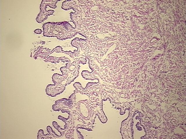 Frozen Tissue Sections, Fallopian tube | CS616608 | OriGene ...