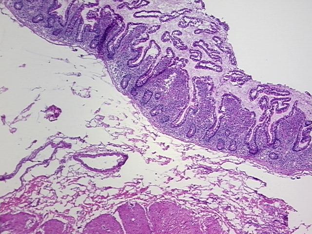 Frozen Tissue Sections, Small intestine | CS619294 | OriGene ...