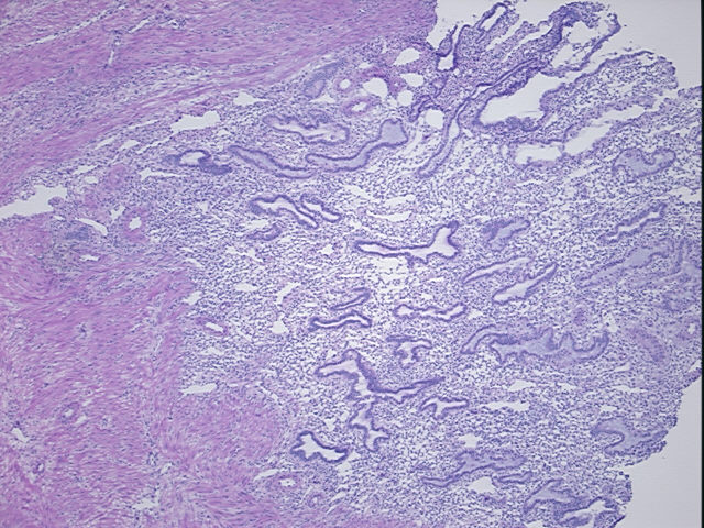 Frozen Tissue Sections, Uterus | OriGene Technologies Inc.