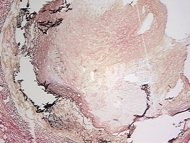 Frozen Tissue Sections, Neurovascular bundle | CS627673 | OriGene ...