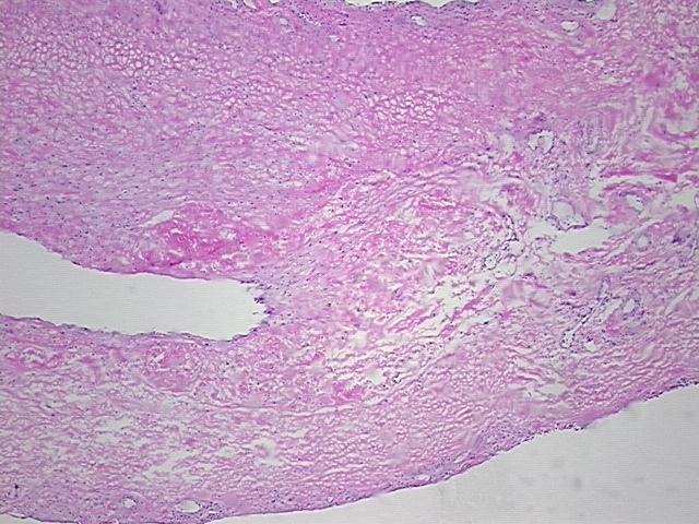 Frozen Tissue Sections, Fibroadipose tissue | OriGene Technologies Inc.