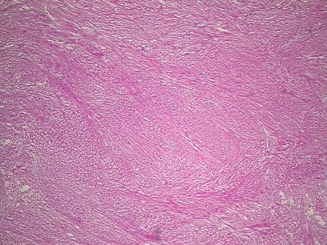 Frozen Tissue Sections, Ovary: right | CS629082 | OriGene Technologies Inc.
