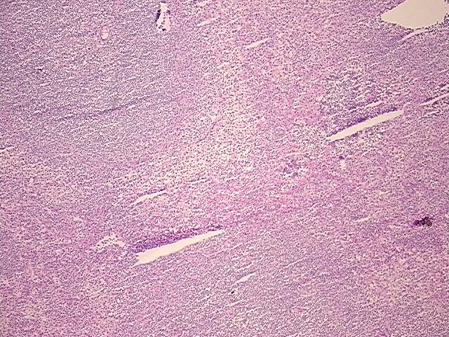 Frozen Tissue Sections, Lymphoid tissue | OriGene Technologies Inc.