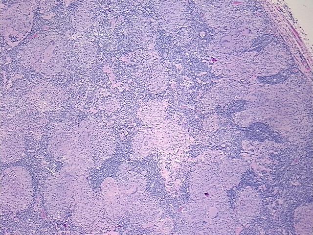 Tissue Ffpe Sections Lymph Node Cs808836 Origene Technologies Inc