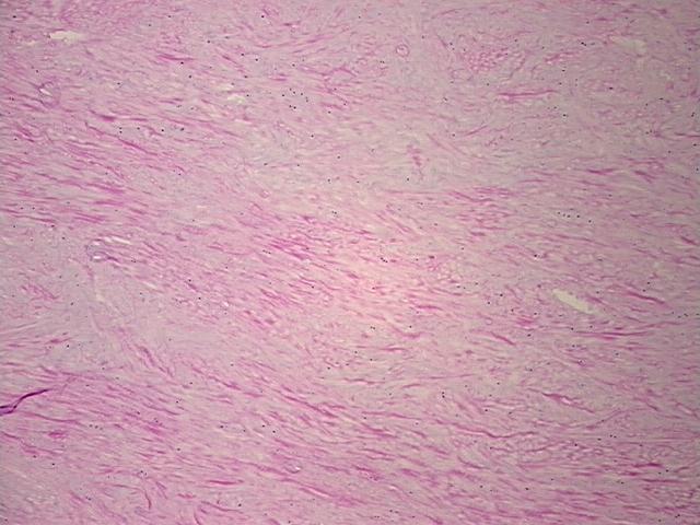Frozen Tissue Sections, Fibrous tissue | CS638711 | OriGene ...