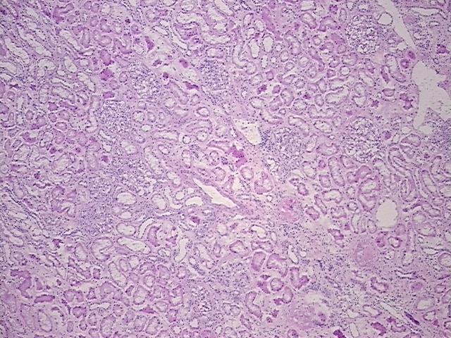 Frozen Tissue Sections, Kidney | CS641998 | OriGene Technologies Inc.
