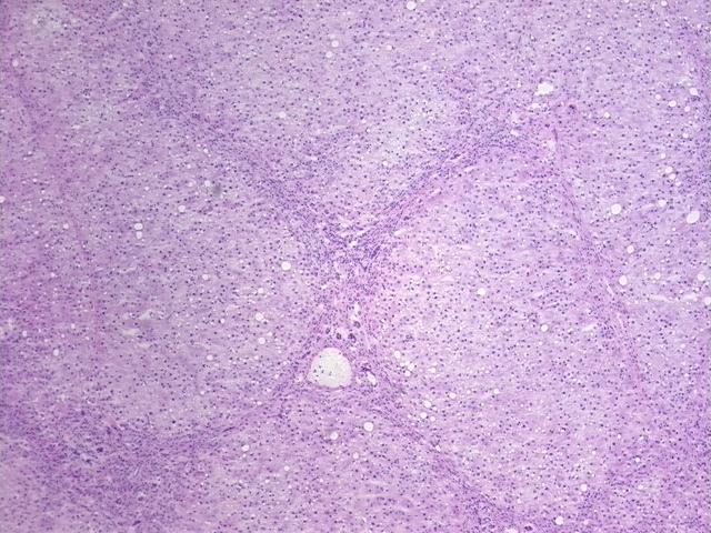 Frozen Tissue Sections, Liver | CS642583 | OriGene Technologies Inc.