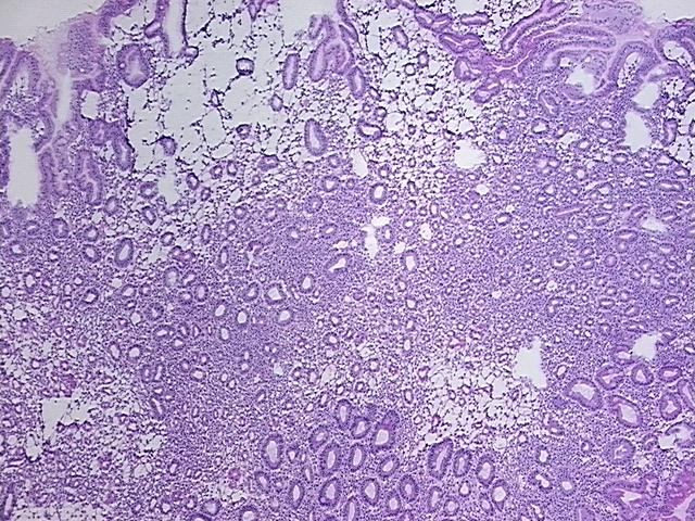 Frozen Tissue Sections, Stomach | CS647378 | OriGene Technologies Inc.